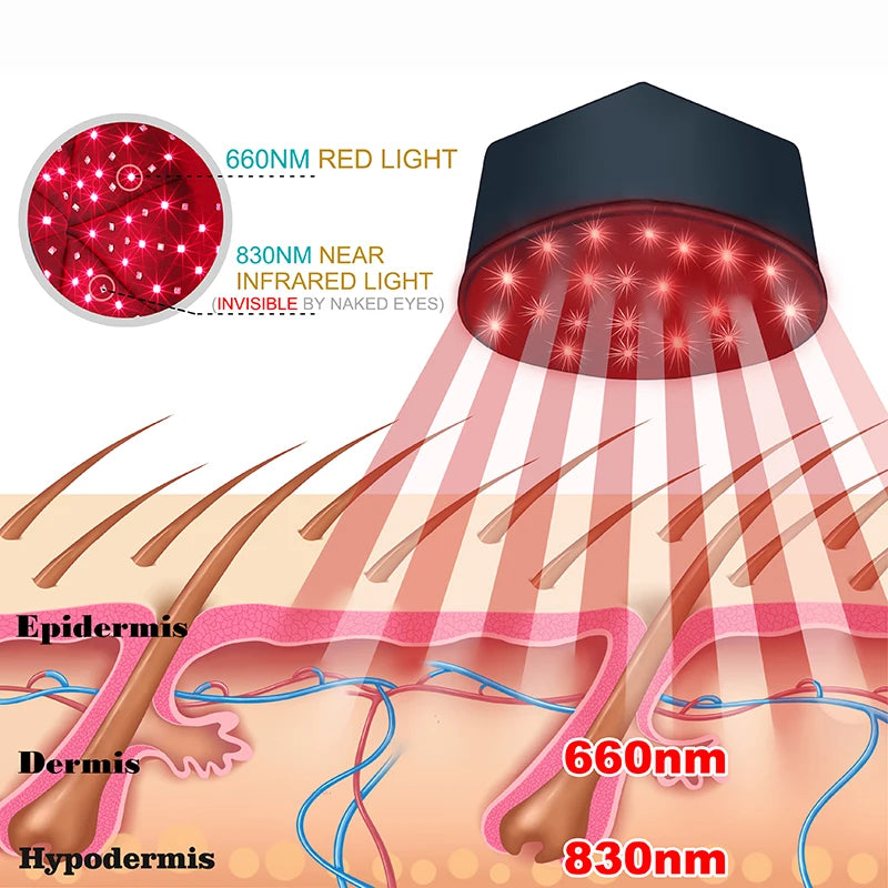 NNEOBA Infrared And Red Light Therapy Hair Growth Cap LED Treatment He ...